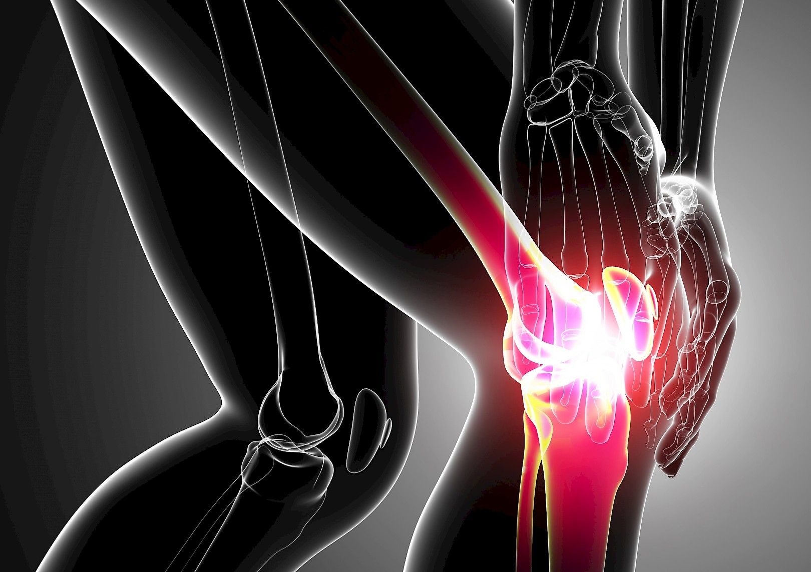 D-vitamiini ei auta polven nivelrikkoon - Lääkärilehti