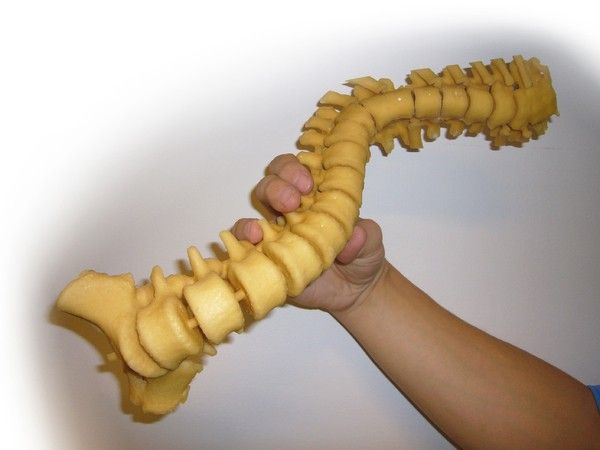 3D-tulostus tulossa lääkärin käyttöön - Lääkärilehti
