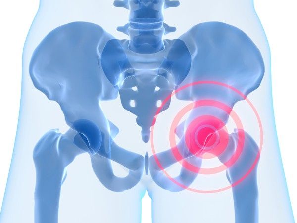 Ultraäänimittauksilla tarkempaa tietoa osteoporoosista - Lääkärilehti