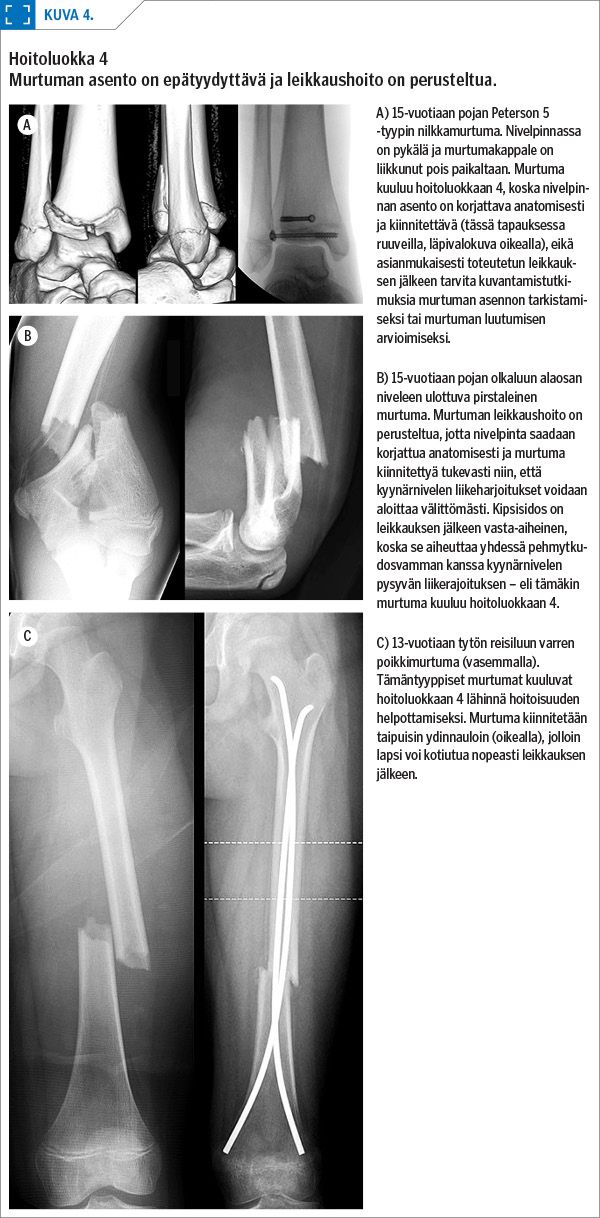 Lääkärilehti - Lasten murtumat ja niiden hoito