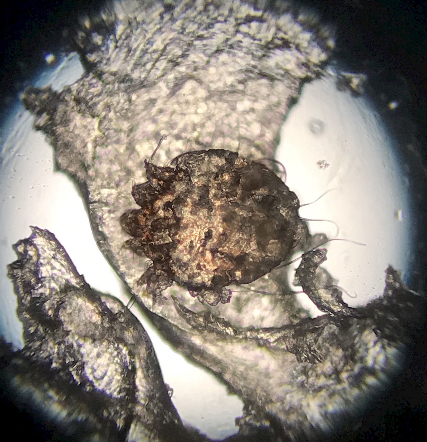 Muista syyhy, kun selvität kutinan syytä - Lääkärilehti