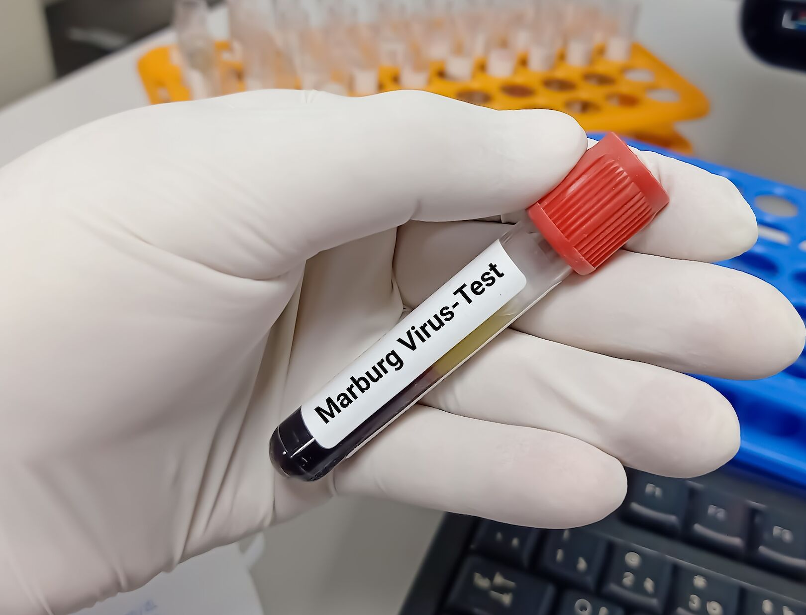 Ruandassa on Marburgin tauti -epidemia - Lääkärilehti